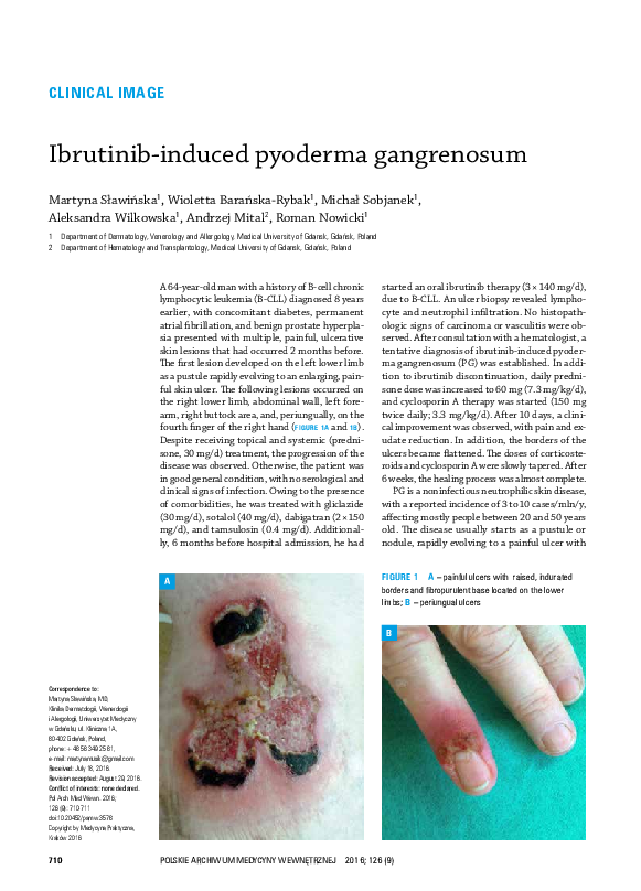 (PDF) Ibrutinib-induced pyoderma gangrenosum