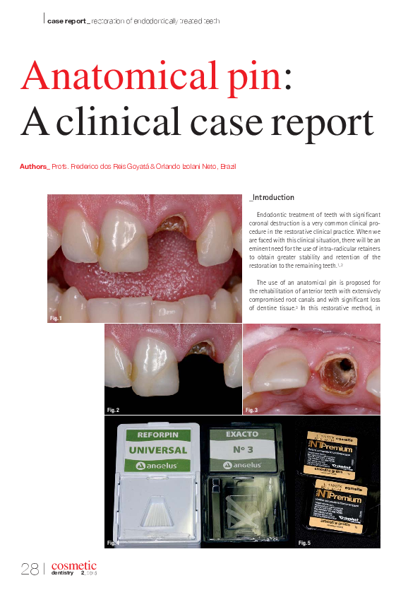 (PDF) Anatomical pin : A clinical case report