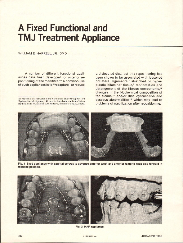 (PDF) A fixed functional and TMJ treatment appliance