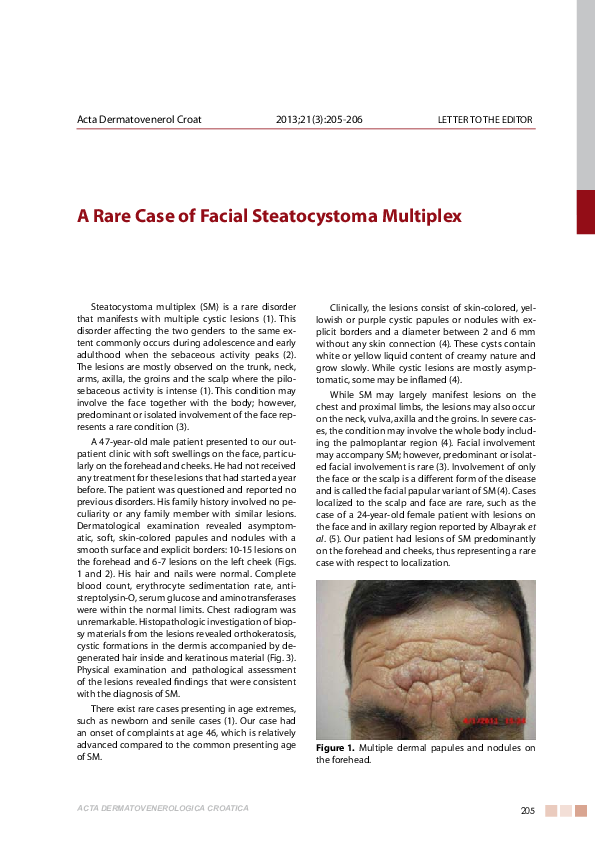 (PDF) A rare case of facial steatocystoma multiplex