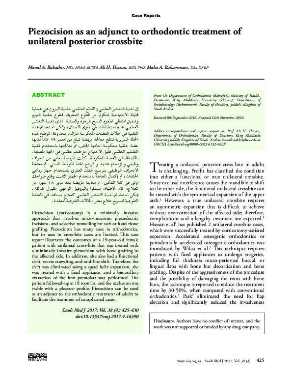 (PDF) Piezocision as an adjunct to orthodontic treatment of unilateral ...