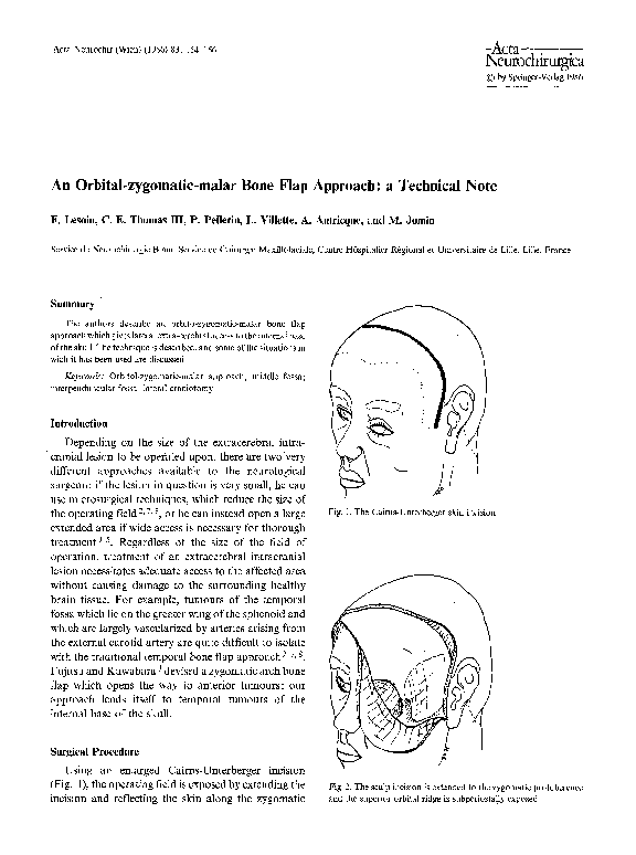 (PDF) An orbital-zygomatic-malar bone flap approach: a technical note