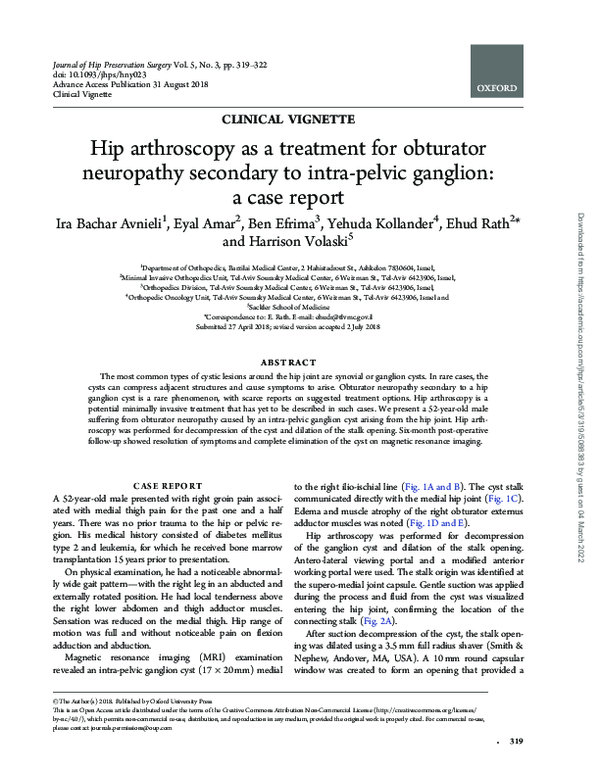 (PDF) Hip arthroscopy as a treatment for obturator neuropathy secondary ...
