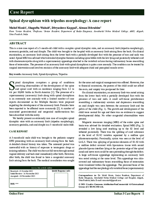 (PDF) Spinal dysraphism with tripedus morphology: A case report