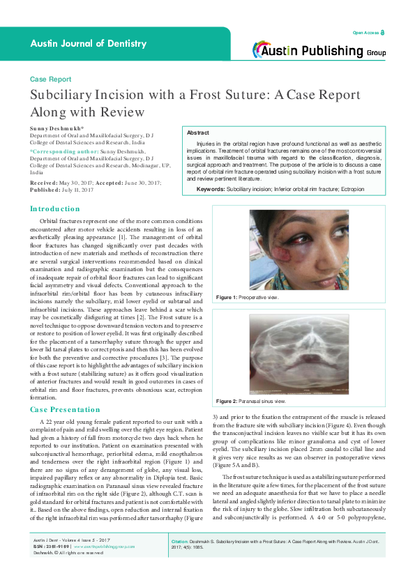 (PDF) Subciliary Incision with a Frost Suture: A Case Report Along with ...