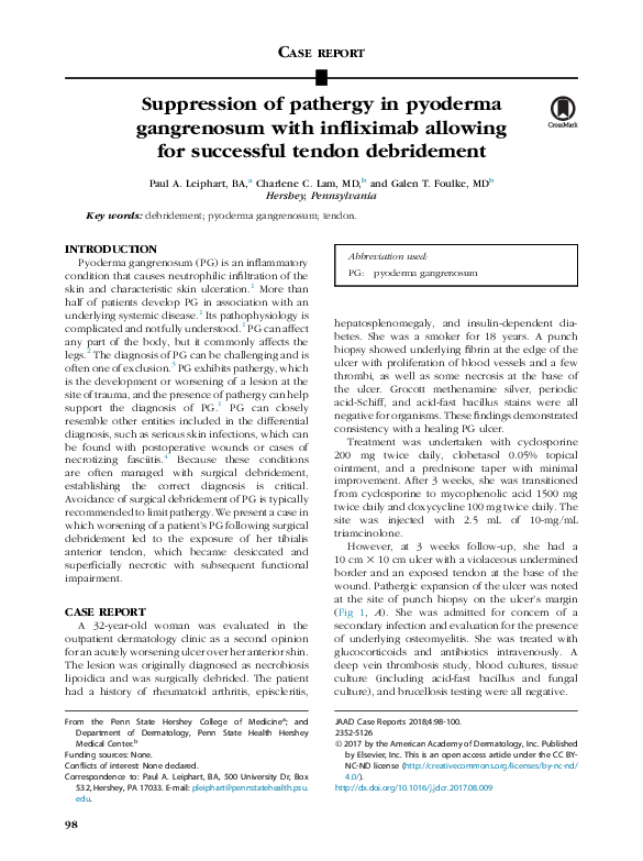(PDF) Suppression of pathergy in pyoderma gangrenosum with infliximab ...