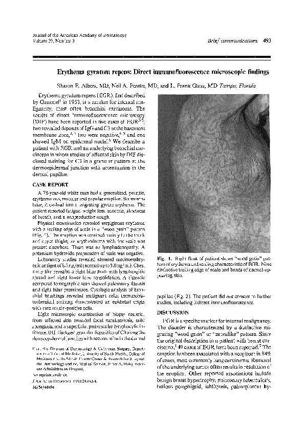 (PDF) Erythema gyratum repens: Direct immunofluorescence microscopic ...