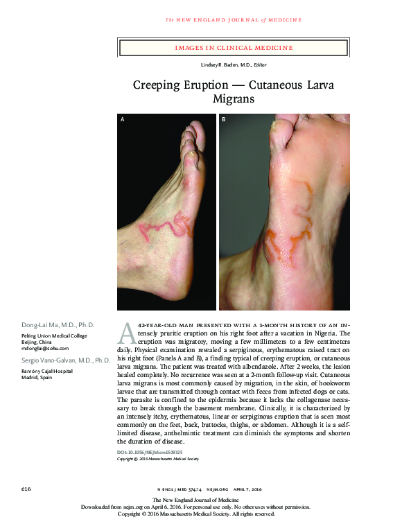 (PDF) Creeping Eruption—Cutaneous Larva Migrans