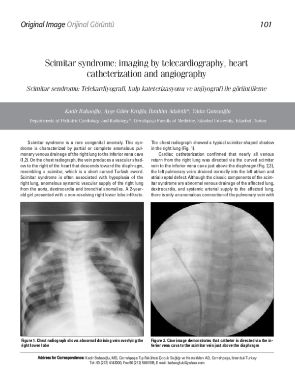 (PDF) Scimitar syndrome: imaging by telecardiography, heart ...