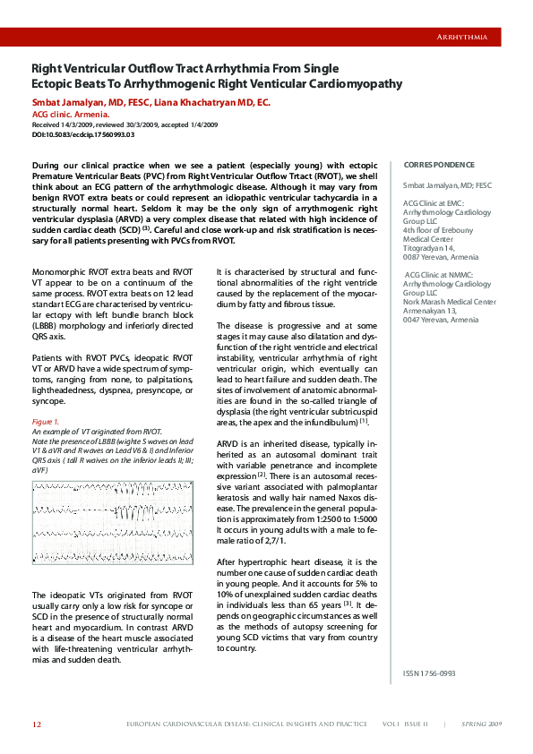 (PDF) Right Ventricular Outflow Tract Arrhythmia From Single Ectopic ...