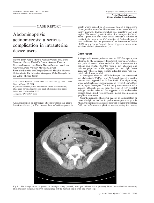 (PDF) Acute complete nonpuerperal uterine inversion