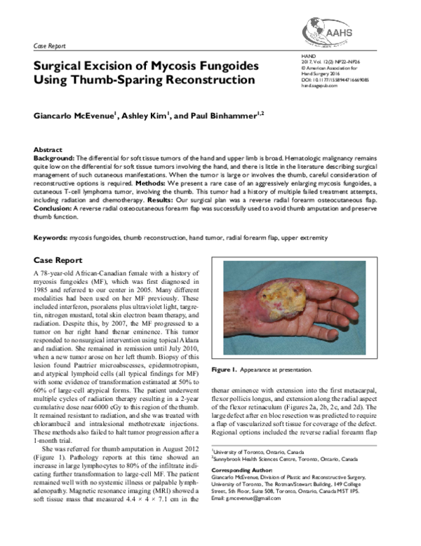 (PDF) Surgical Excision of Mycosis Fungoides Using Thumb-Sparing ...
