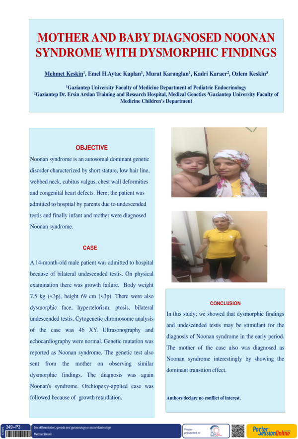 (PDF) Mother and Baby Diagnosed Noonan Syndrome with Dysmorphic Findings