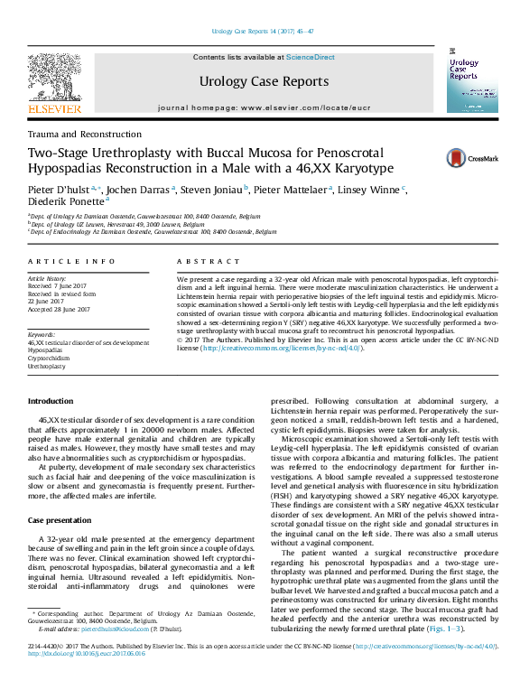 (PDF) Two-Stage Urethroplasty with Buccal Mucosa for Penoscrotal ...