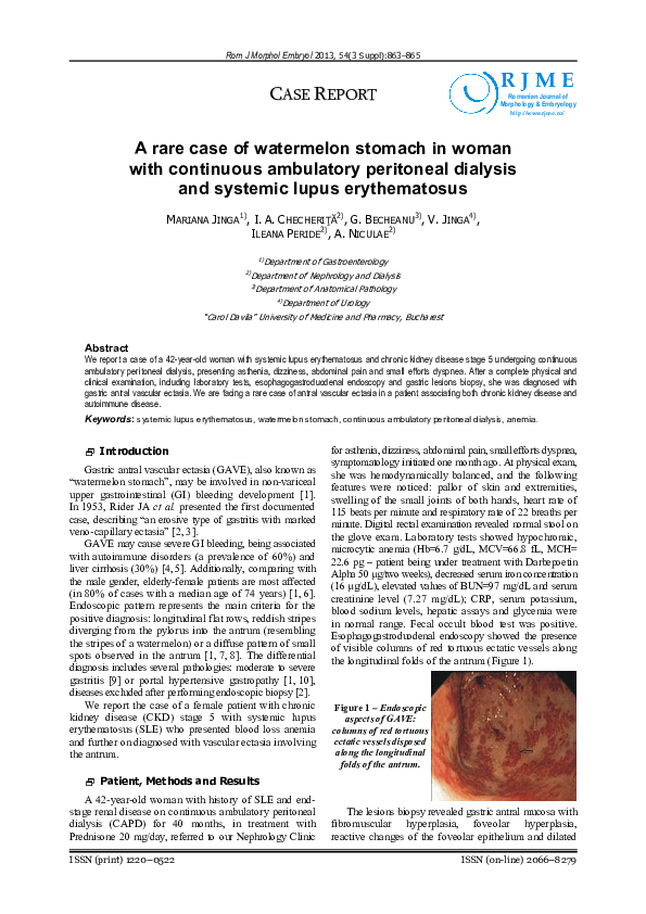 (PDF) A rare case of watermelon stomach in woman with continuous ...