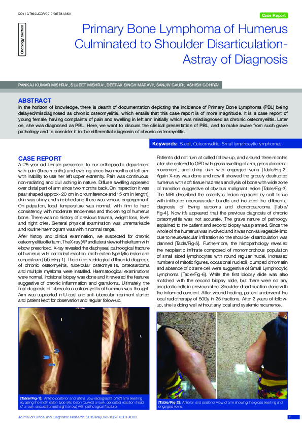 (PDF) Primary Bone Lymphoma of Humerus Culminated to Shoulder ...
