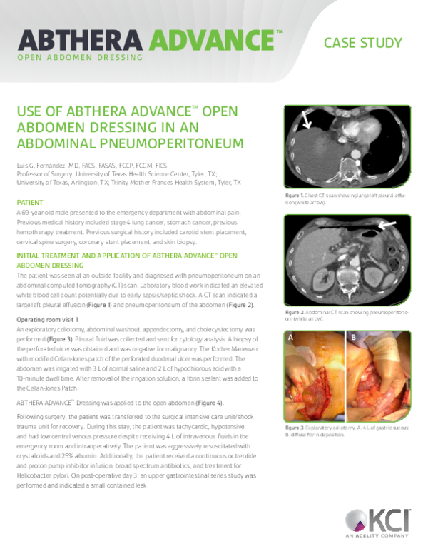 (PDF) USE OF ABTHERA ADVANCE ™ OPEN ABDOMEN DRESSING IN AN ABDOMINAL ...