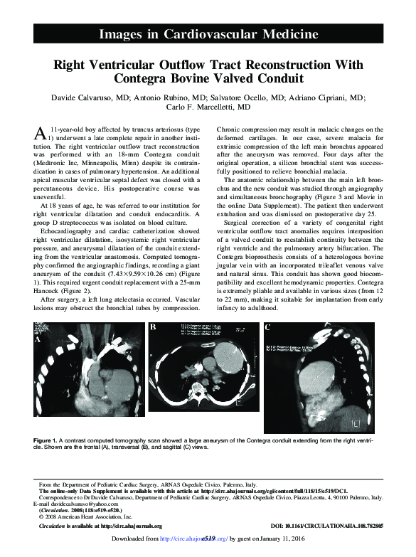 (PDF) Right Ventricular Outflow Tract Reconstruction With Contegra ...