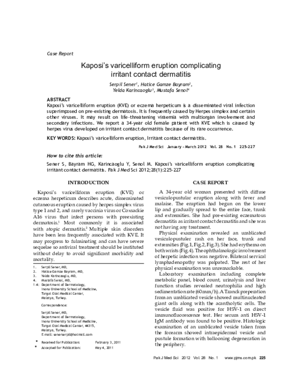 (PDF) Kaposi's varicelliform eruption complicating irritant contact ...