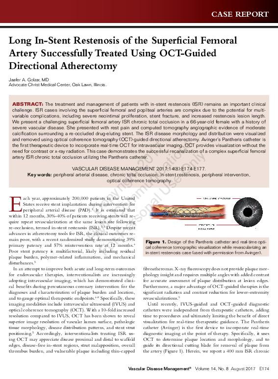 (PDF) Long In-Stent Restenosis of the Superficial Femoral Artery ...