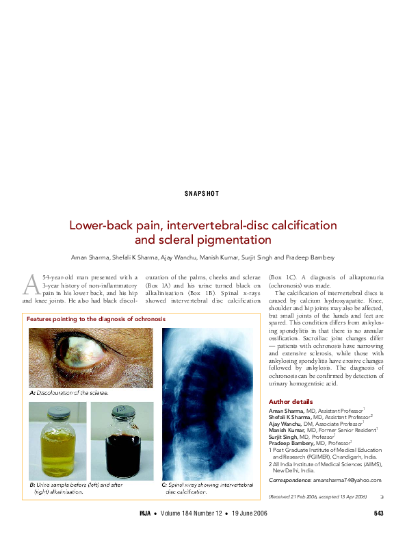 (PDF) Lower-back pain, intervertebral-disc calcification and scleral ...