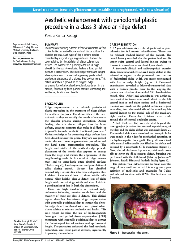 (PDF) Aesthetic enhancement with periodontal plastic procedure in a ...