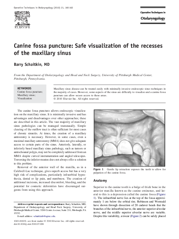 (PDF) Canine fossa puncture: Safe visualization of the recesses of the ...