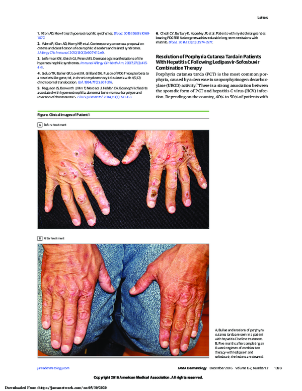 (PDF) Prevalence of hepatitis C virus infection in porphyria cutanea ...
