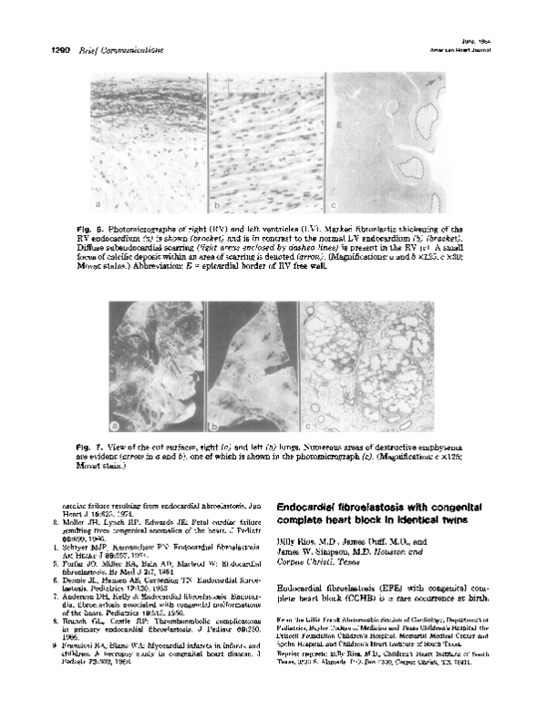 (PDF) Endocardial fibroelastosis with congenital complete heart block ...