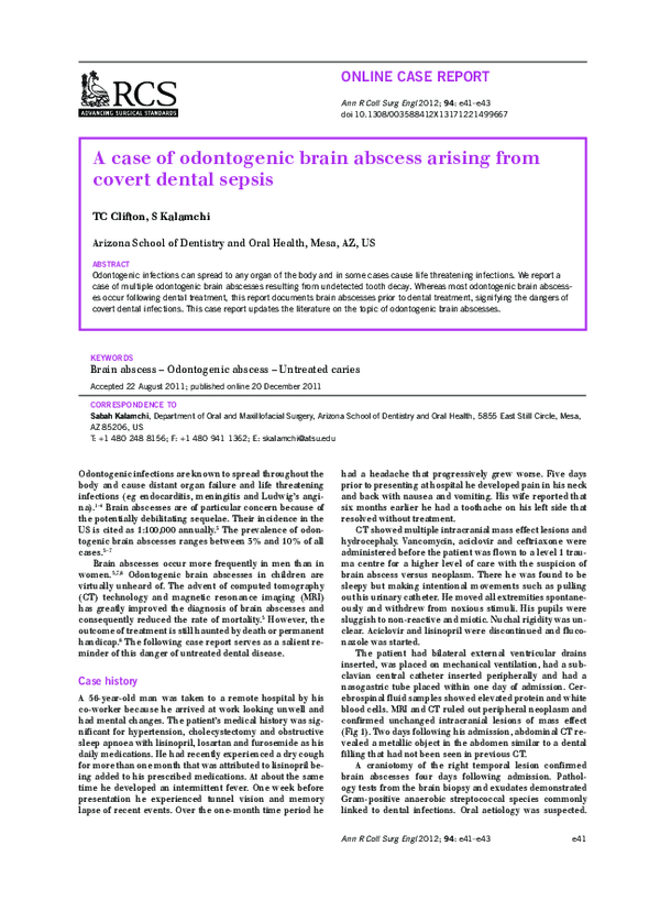 (PDF) A case of odontogenic brain abscess arising from covert dental sepsis