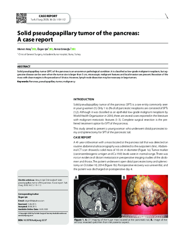 (PDF) Solid pseudopapillary tumor of the pancreas: A case report | Judith Pérez Rojas - Academia.edu