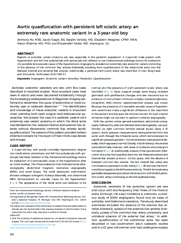 (PDF) Aortic quadfurcation with persistent left sciatic artery: an ...