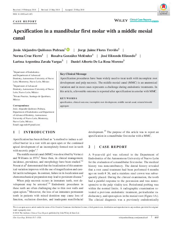 (PDF) Apexification in a mandibular first molar with a middle mesial canal