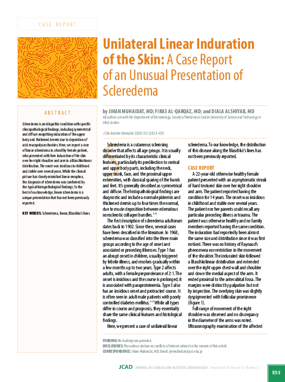 (PDF) Unilateral Linear Induration of the Skin: A Case Report of an ...