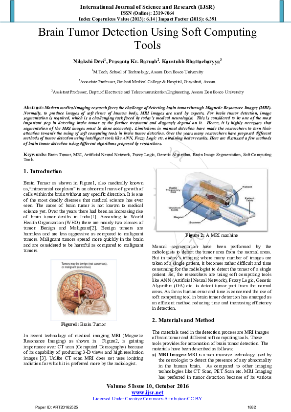 Pdf Soft Computing For Mri Brain Tumor Detection