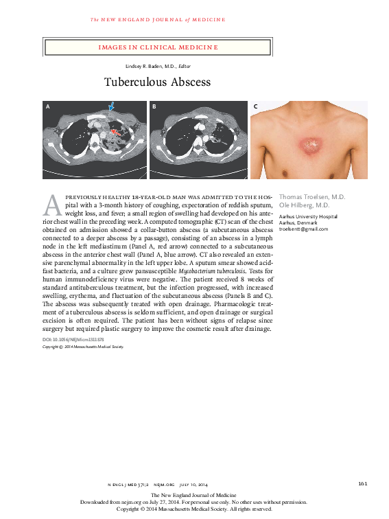 (PDF) Images in clinical medicine. Tuberculous abscess