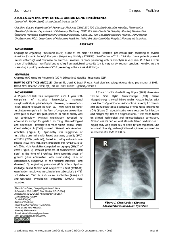 (PDF) Atoll Sign in Cryptogenic Organizing Pneumonia