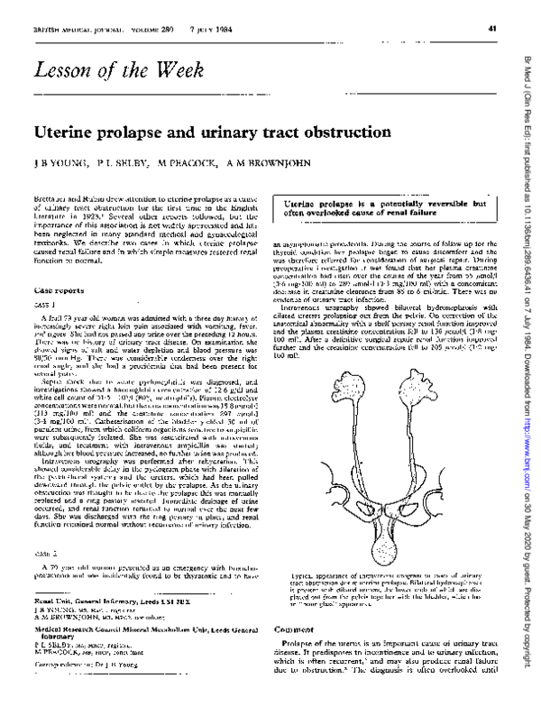 (PDF) Uterine prolapse and urinary tract obstruction