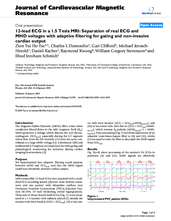 (PDF) 12-lead ECG in a 1.5 Tesla MRI: Separation of real ECG and MHD ...