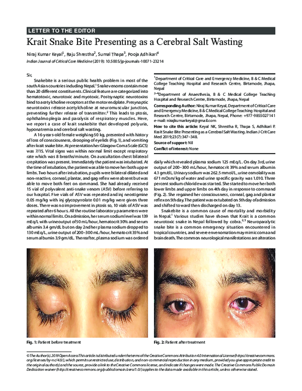(PDF) Krait Snake Bite Presenting as a Cerebral Salt Wasting