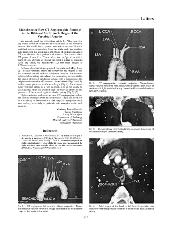 (PDF) Multidetector-row CT angiographic findings in the bilateral ...