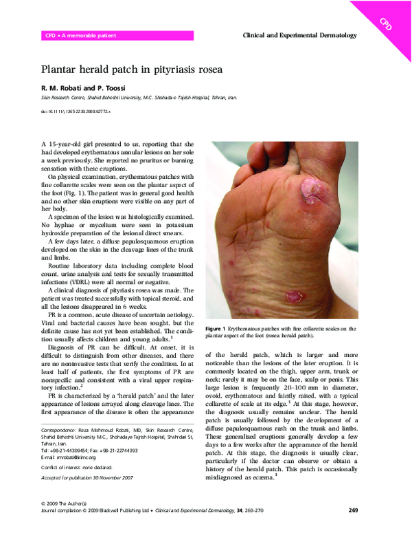 (PDF) Plantar herald patch in pityriasis rosea