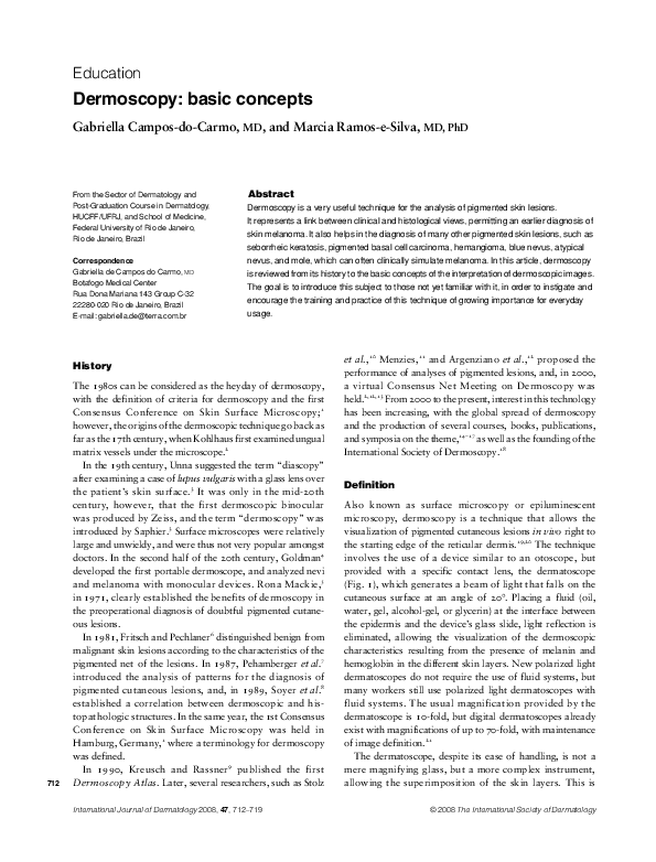 (PDF) Dermoscopy: basic concepts