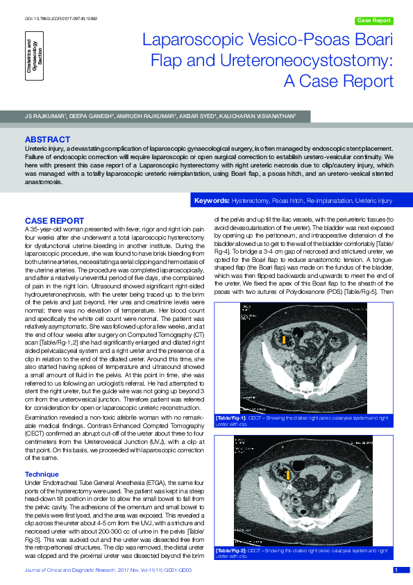 (PDF) Laparoscopic Vesico-Psoas Boari Flap and Ureteroneocystostomy: A ...