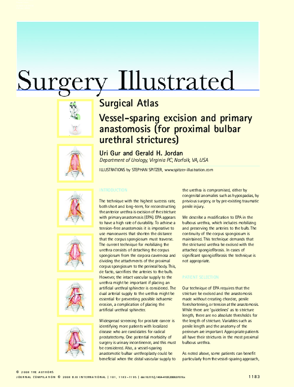 (PDF) Vessel-sparing excision and primary anastomosis (for proximal ...