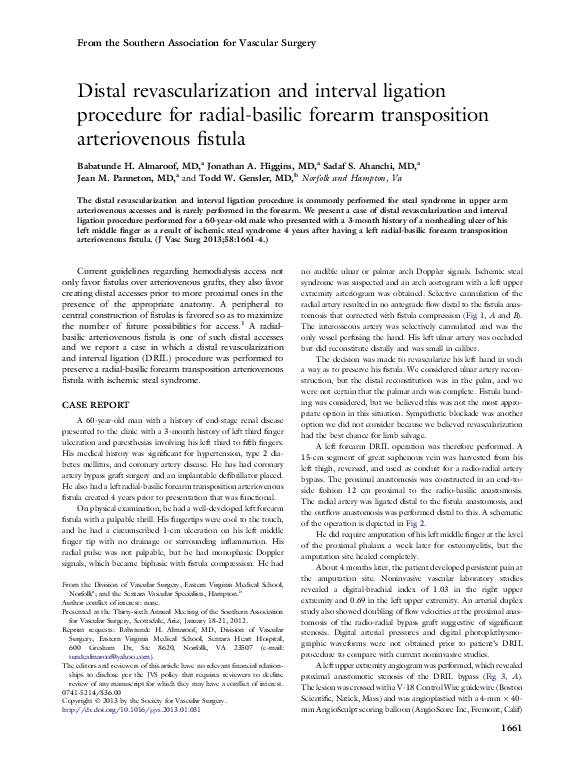 (PDF) Distal revascularization and interval ligation procedure for ...