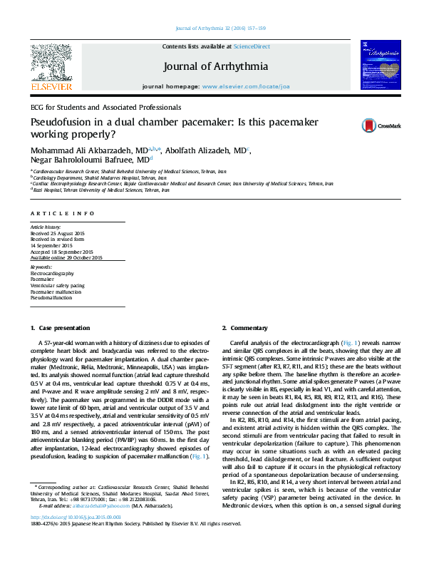 (PDF) Pseudofusion in a dual chamber pacemaker: Is this pacemaker ...