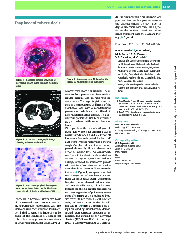 (PDF) Esophageal tuberculosis