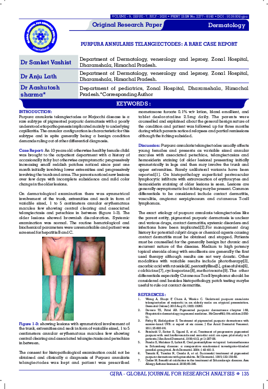 (PDF) Purpura annularis telangiectodes a rare case report July ...