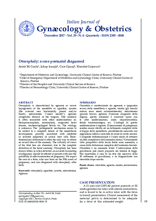 (PDF) Otocephaly: a case postnatal diagnosed